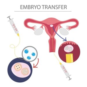 After Embryo Transfer Day by Day Symptoms - Nandi IVF
