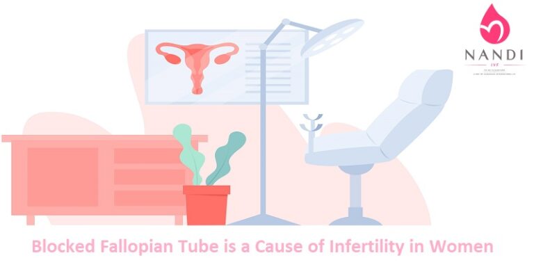 Blocked Fallopian Tube is a Cause of Infertility in Women?
